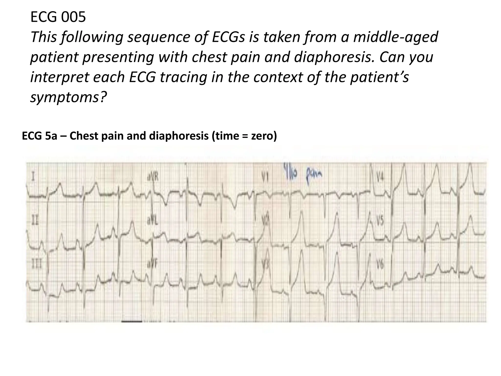ECG life in the fastlane.pptx