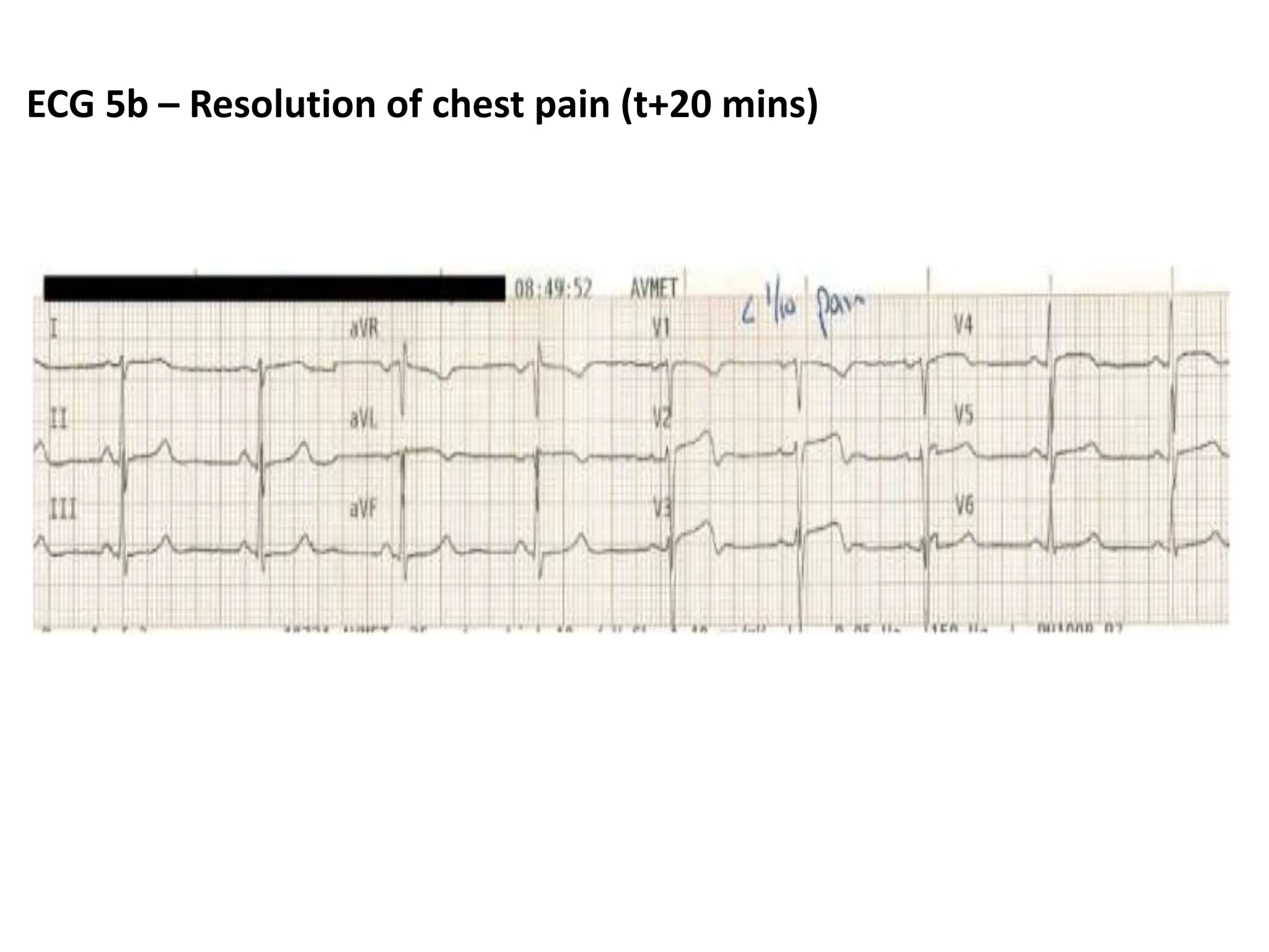 ECG life in the fastlane.pptx