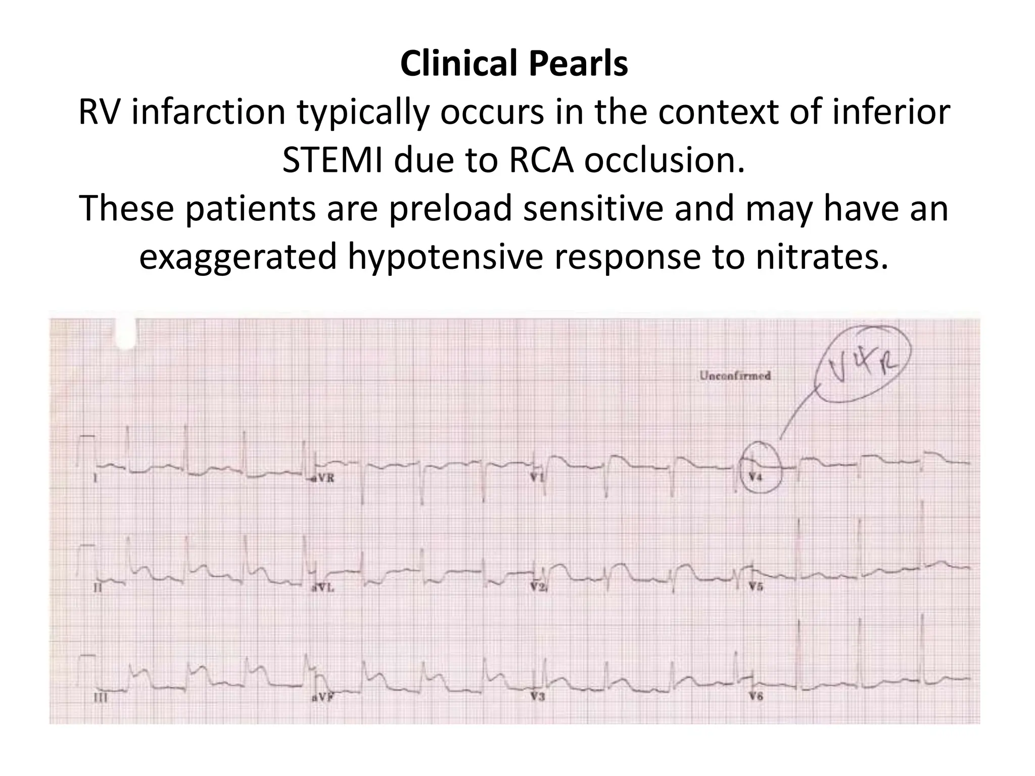 ECG life in the fastlane.pptx