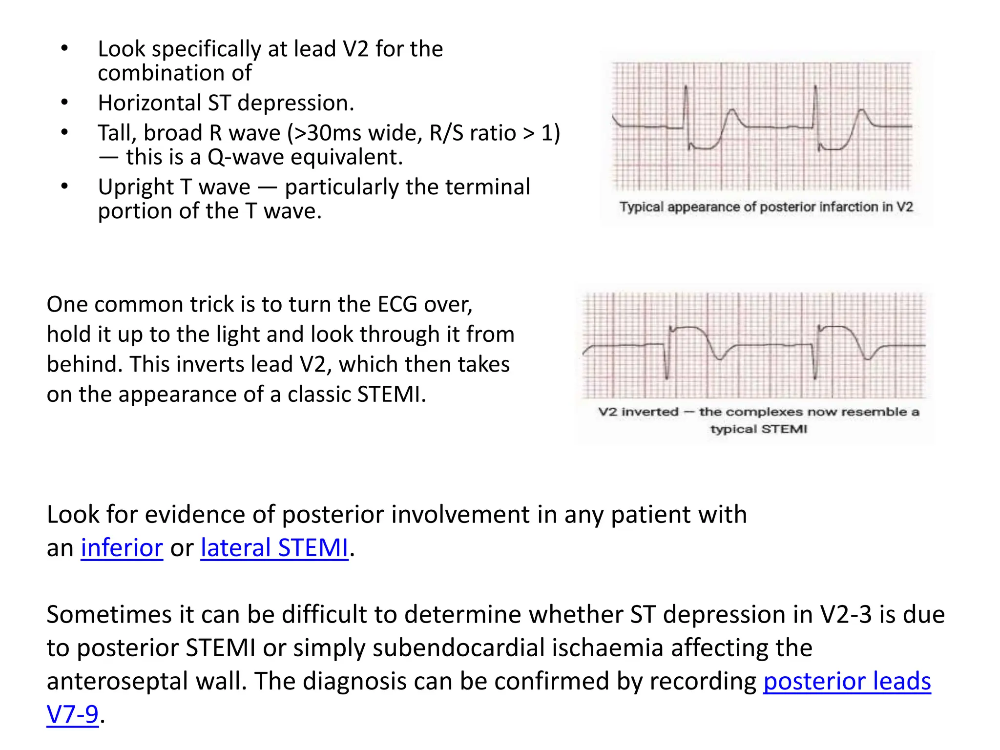 ECG life in the fastlane.pptx