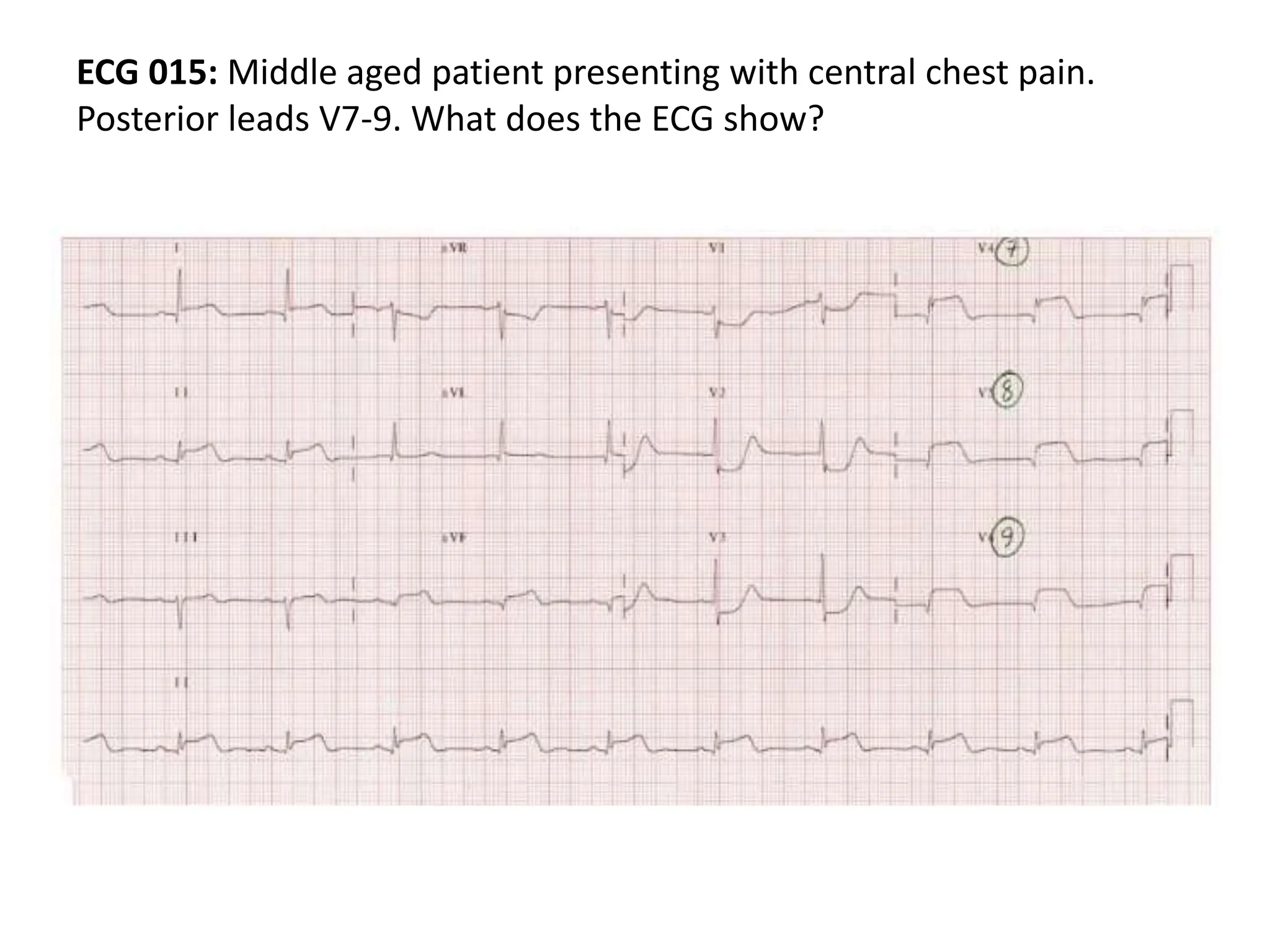 ECG life in the fastlane.pptx