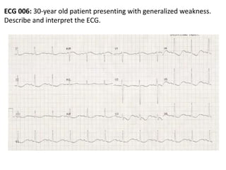 ECG life in the fastlane.pptx