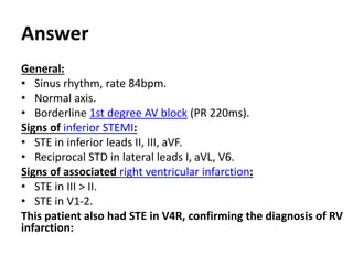 ECG life in the fastlane.pptx