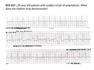ECG life in the fastlane.pptx
