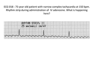 ECG life in the fastlane.pptx