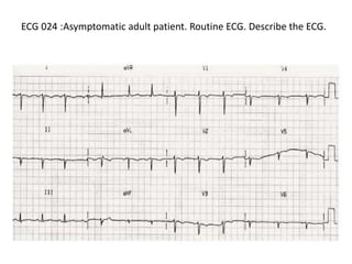 ECG life in the fastlane.pptx