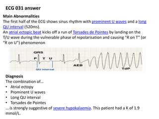 ECG life in the fastlane.pptx