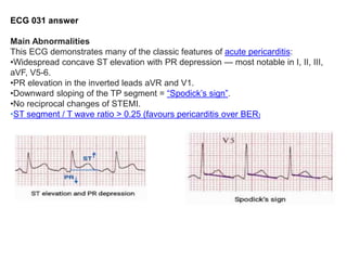 ECG life in the fastlane.pptx