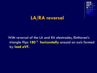 ECG LIMB LEAD REVERSAL | PPTX