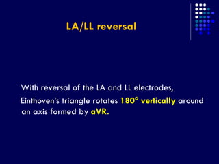 ECG LIMB LEAD REVERSAL | PPTX