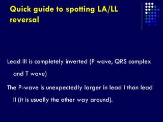 ECG LIMB LEAD REVERSAL | PPTX