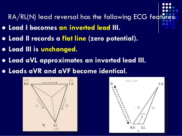 ECG LIMB LEAD REVERSAL
