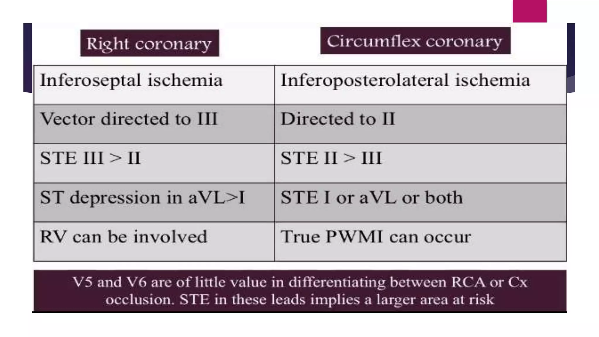 Ecg Localization Of Myocardial Infarction Pptx Heart And