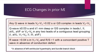 Ecg localization of myocardial infarction | PPTX
