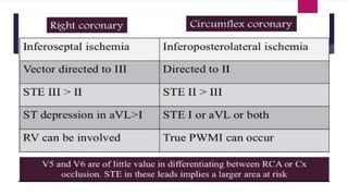 Ecg localization of myocardial infarction | PPTX
