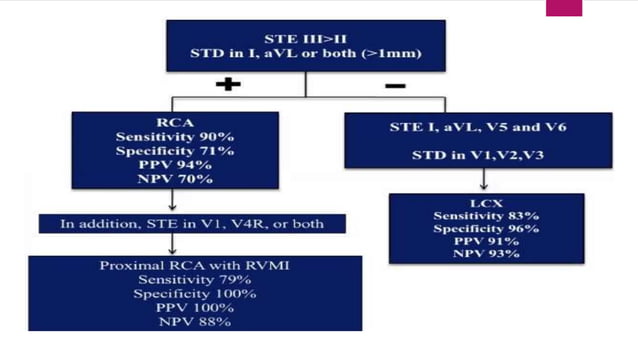 Ecg localization of myocardial infarction | PPTX | Heart and ...