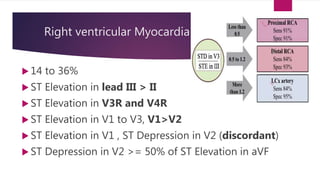 Ecg localization of myocardial infarction | PPTX