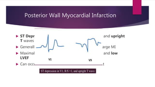 Ecg localization of myocardial infarction | PPTX