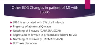 Ecg localization of myocardial infarction | PPTX