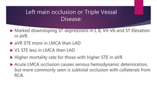 Ecg localization of myocardial infarction | PPTX