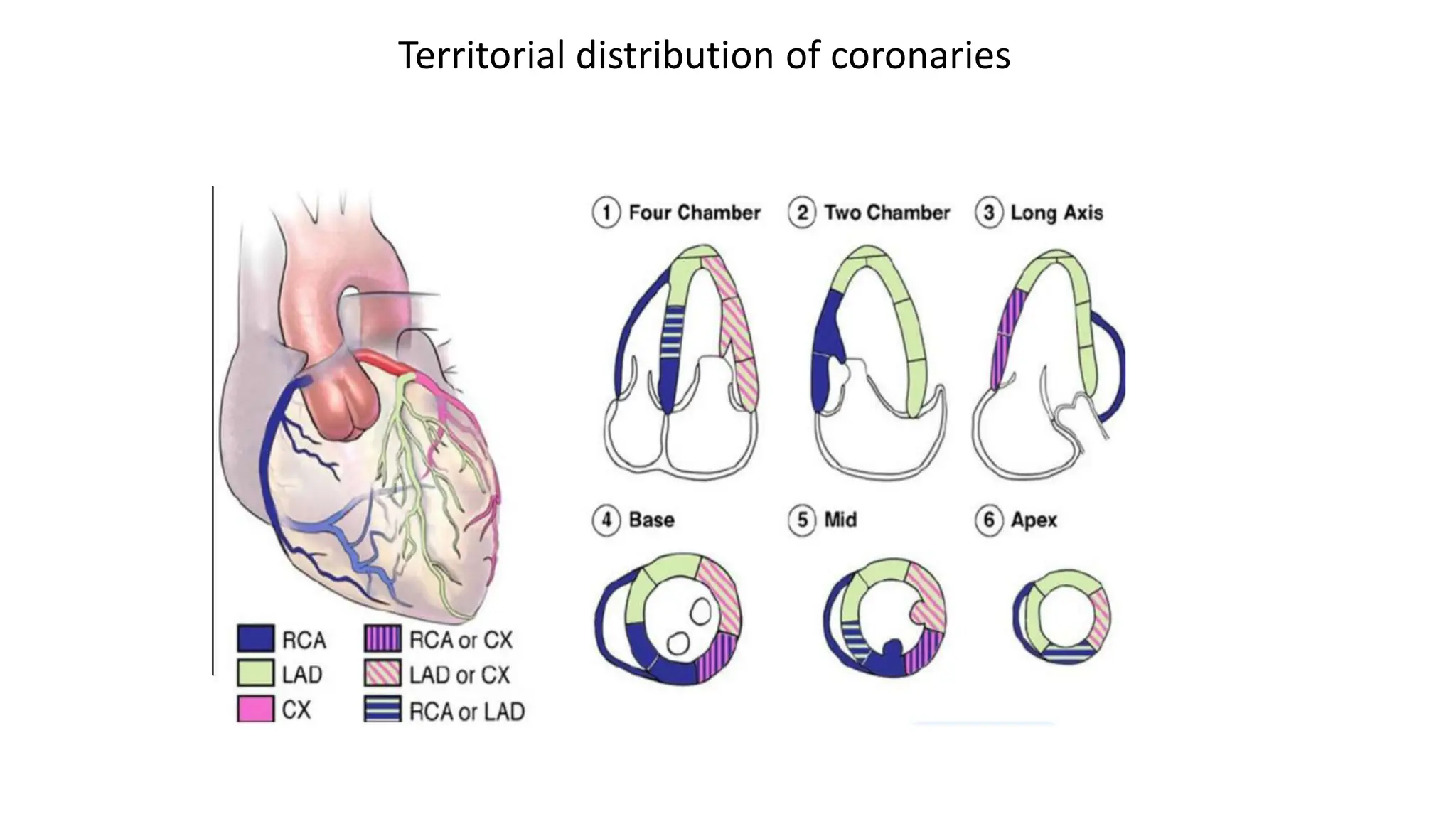 ECG LOCALIZTION OF CULPRIT VESSEL IN MI.pptx