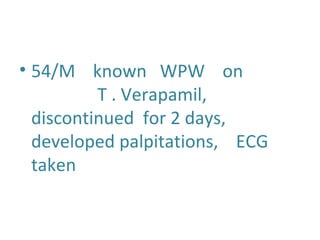 ECG: Wide Complex Tachycardia | PPT