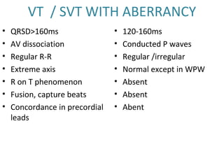 ECG: Wide Complex Tachycardia | PPT