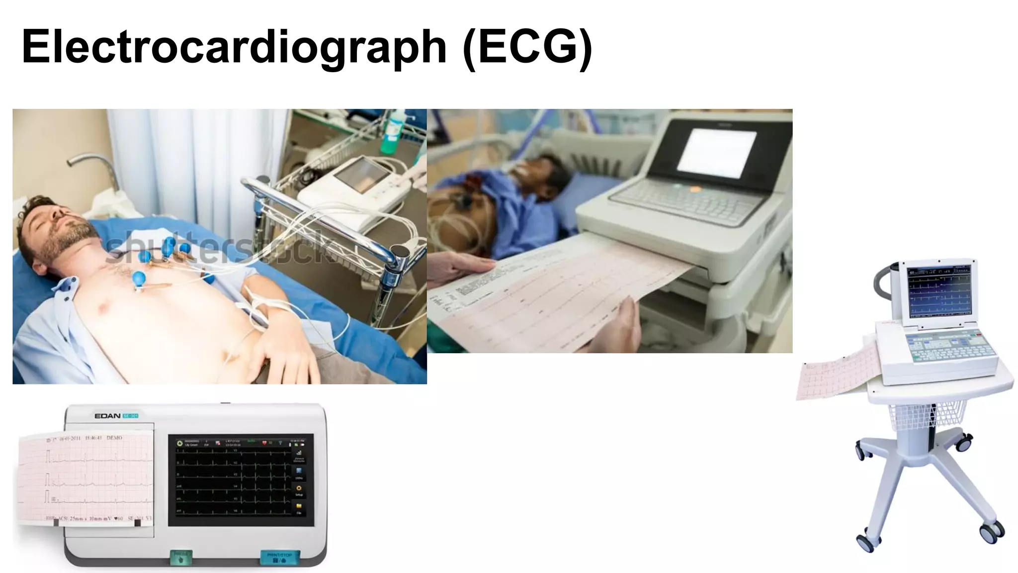 Ecg machine | PDF