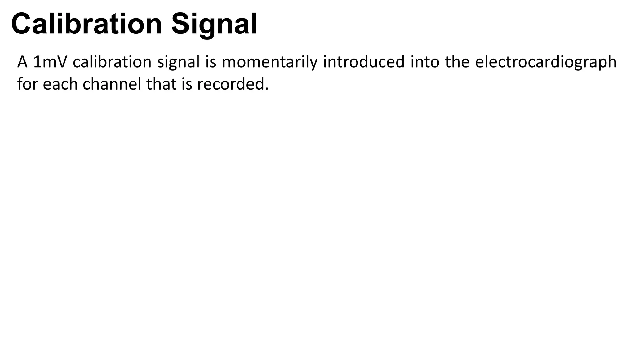 Ecg machine | PDF