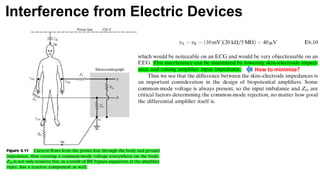 Ecg machine | PDF