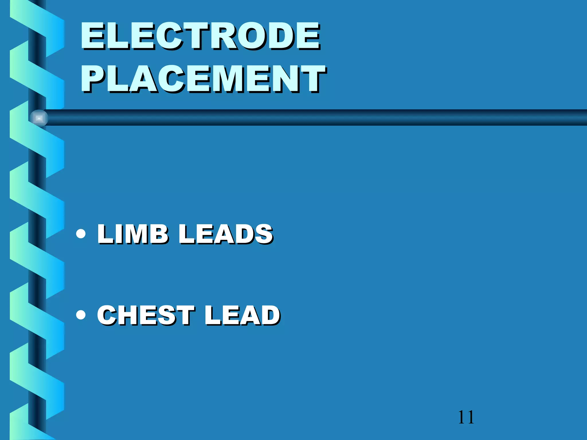 Ecg made easy | PPT