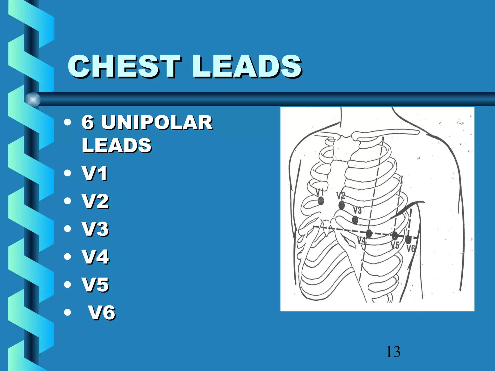 Ecg made easy | PPT