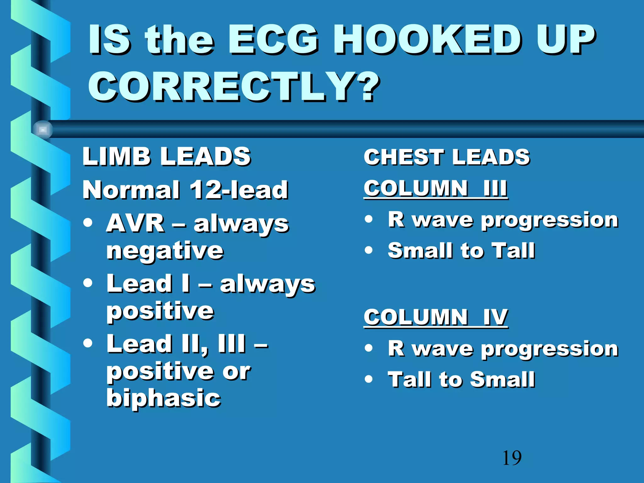 Ecg made easy | PPT