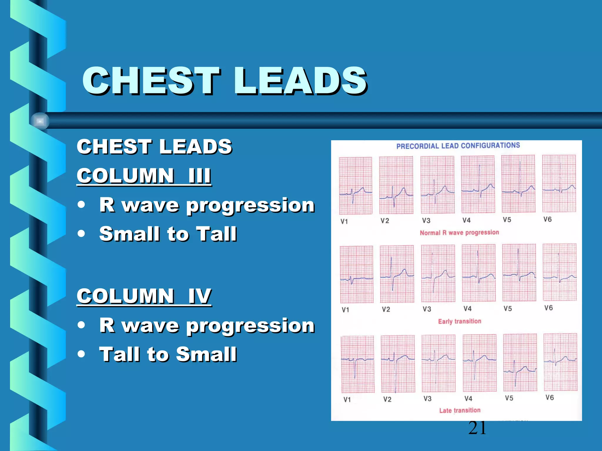 Ecg made easy | PPT