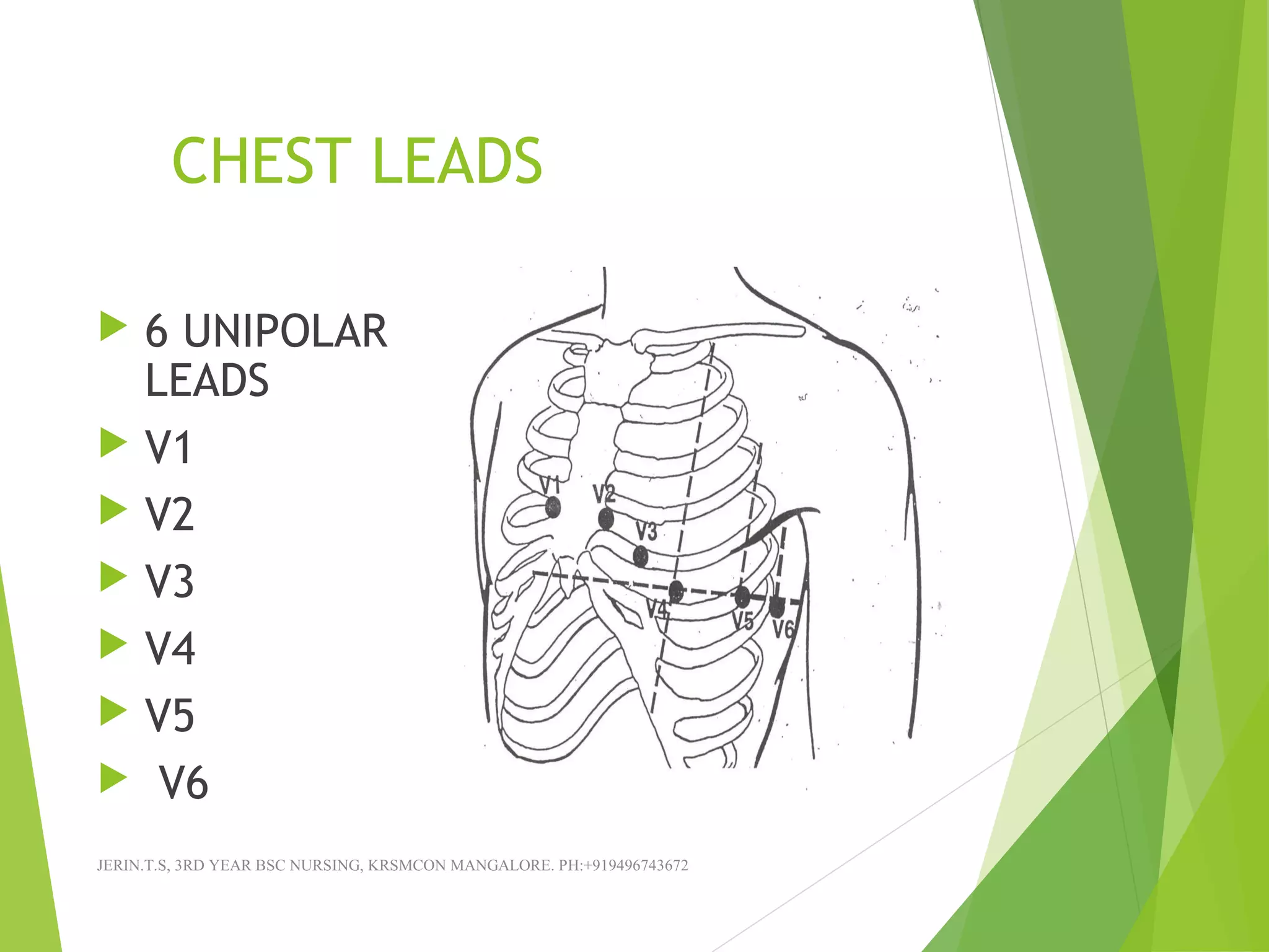 Ecg made easy ppt | PPT
