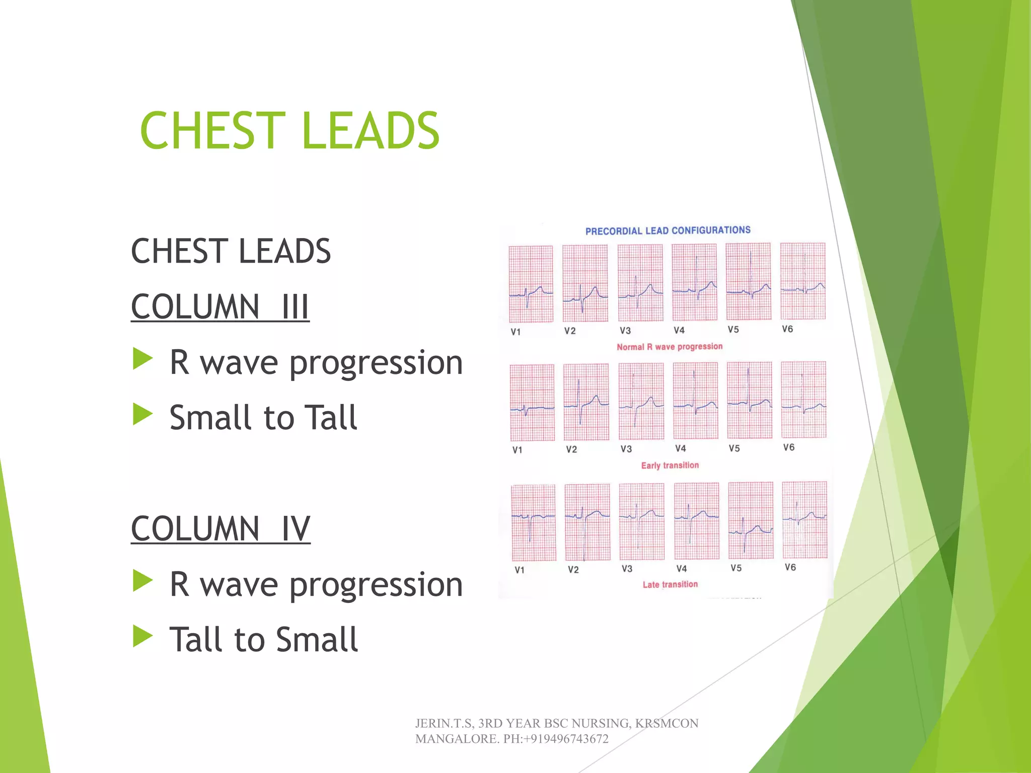 Ecg made easy ppt | PPT