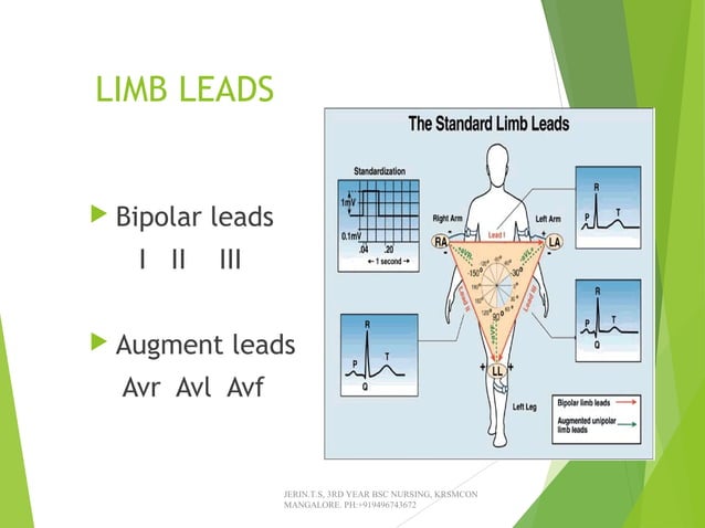 Ecg made easy ppt | PPT