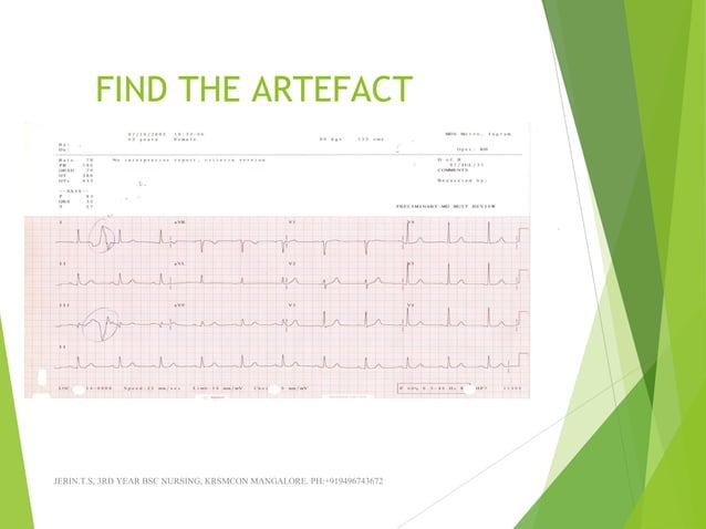 Ecg made easy ppt | PPT