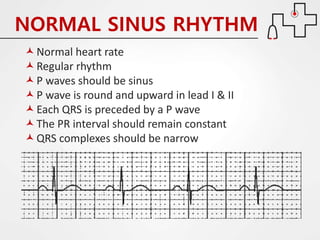 Ecg made easy | PDF