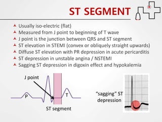 Ecg made easy | PDF