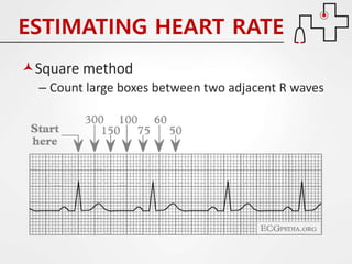ECG Interpretation Cheat Sheet WHAT EXACTLY IS AN ECG? An, 56% OFF