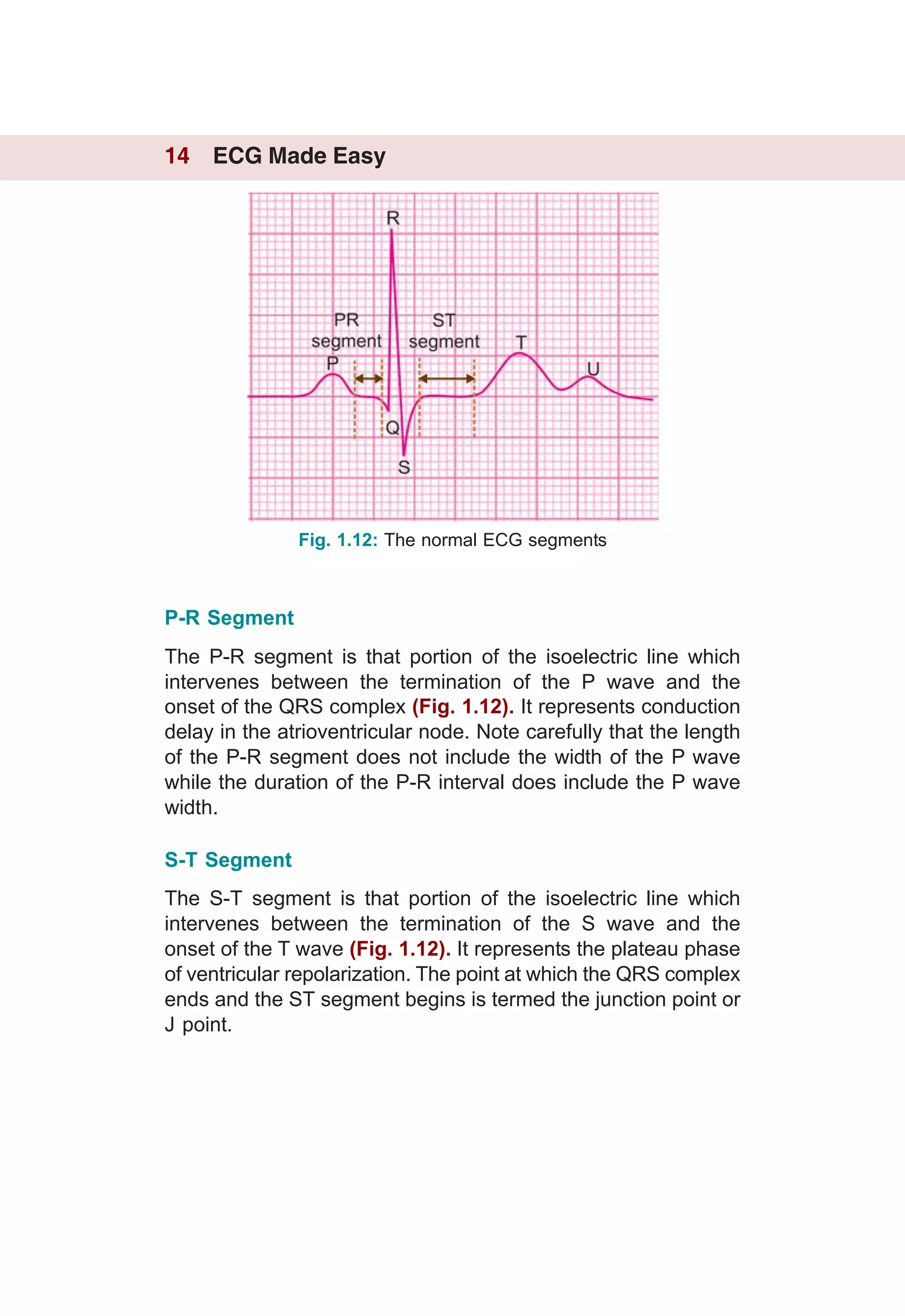 Ecg made easy | PDF