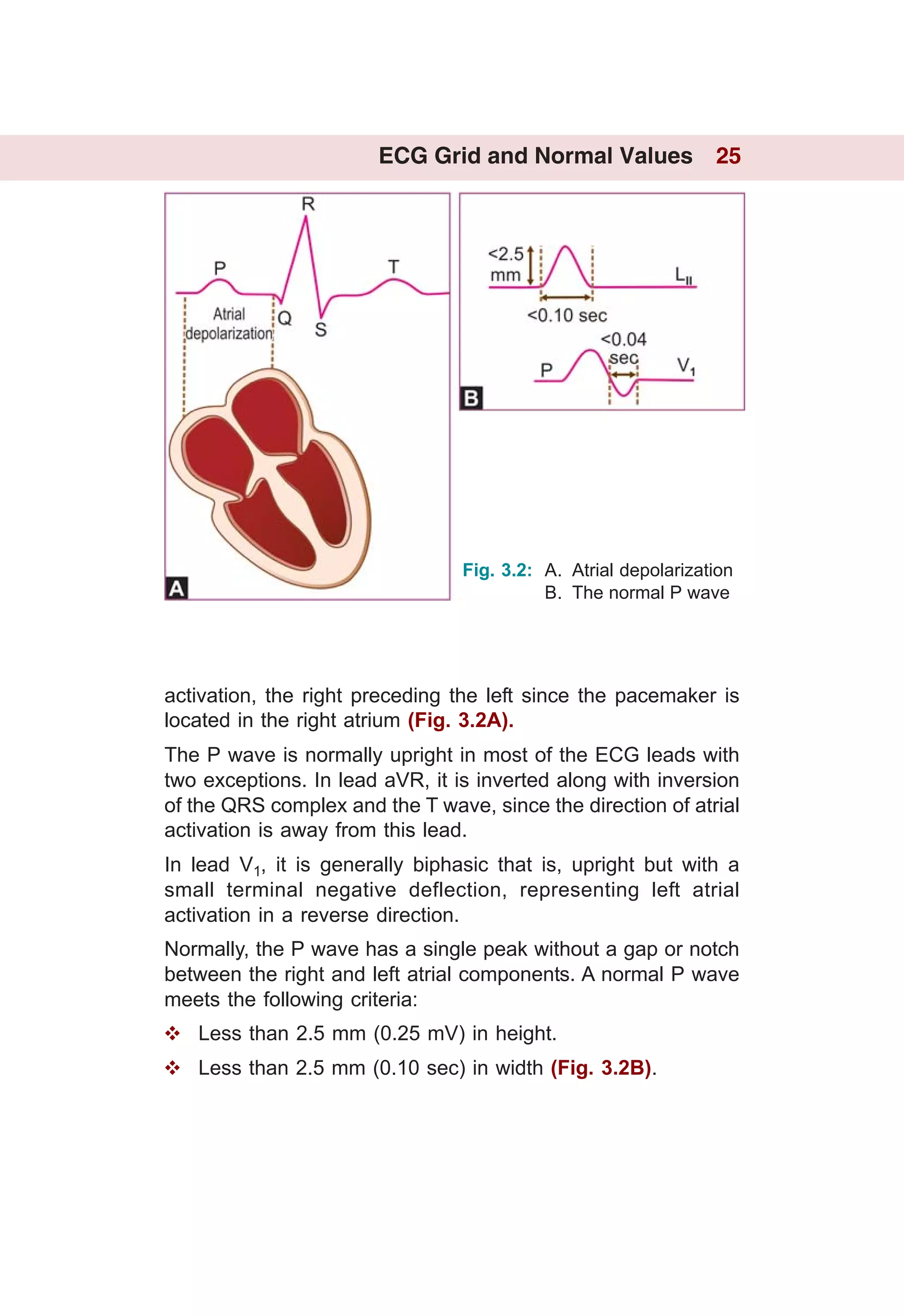 Ecg made easy | PDF