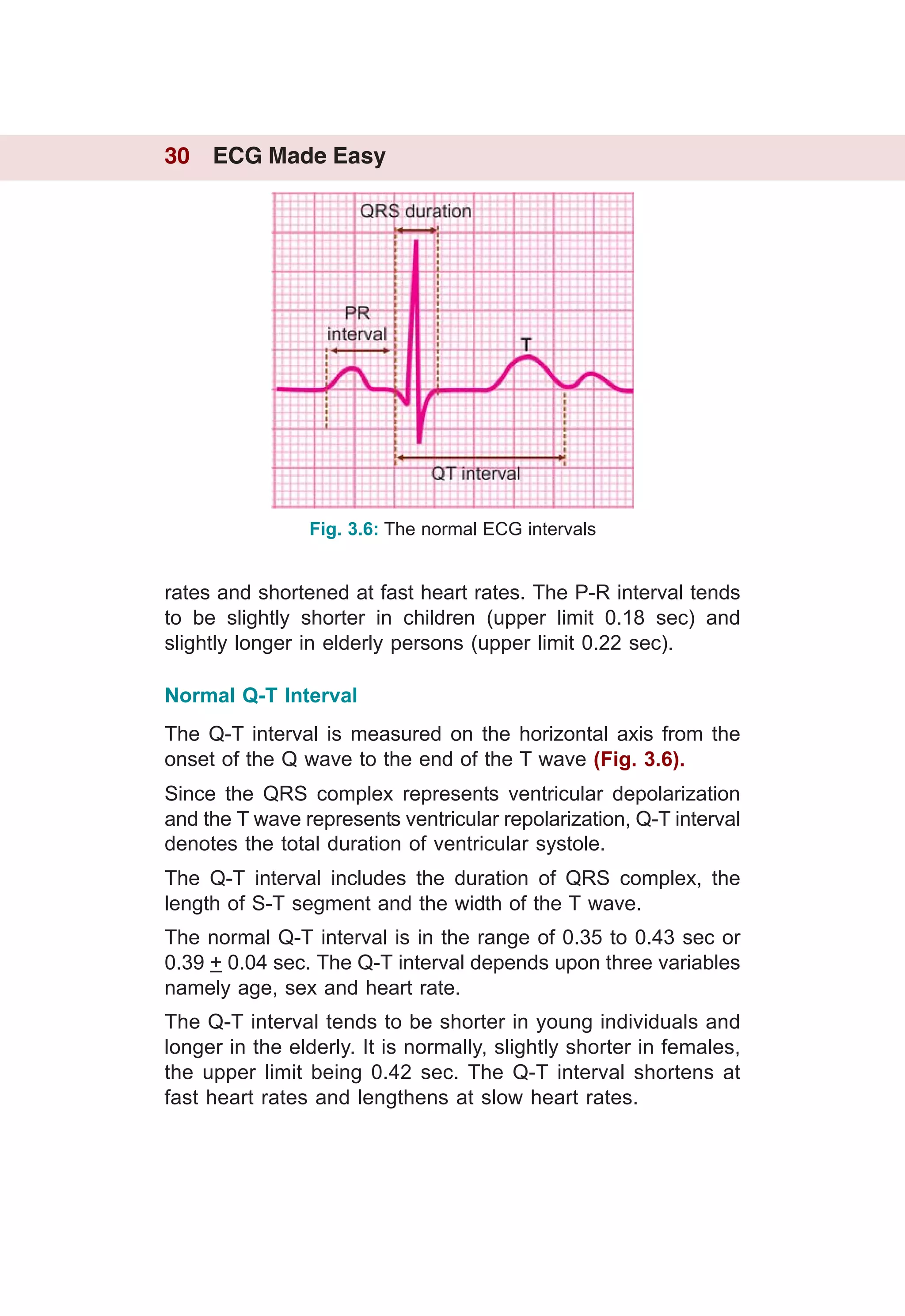 Ecg made easy | PDF