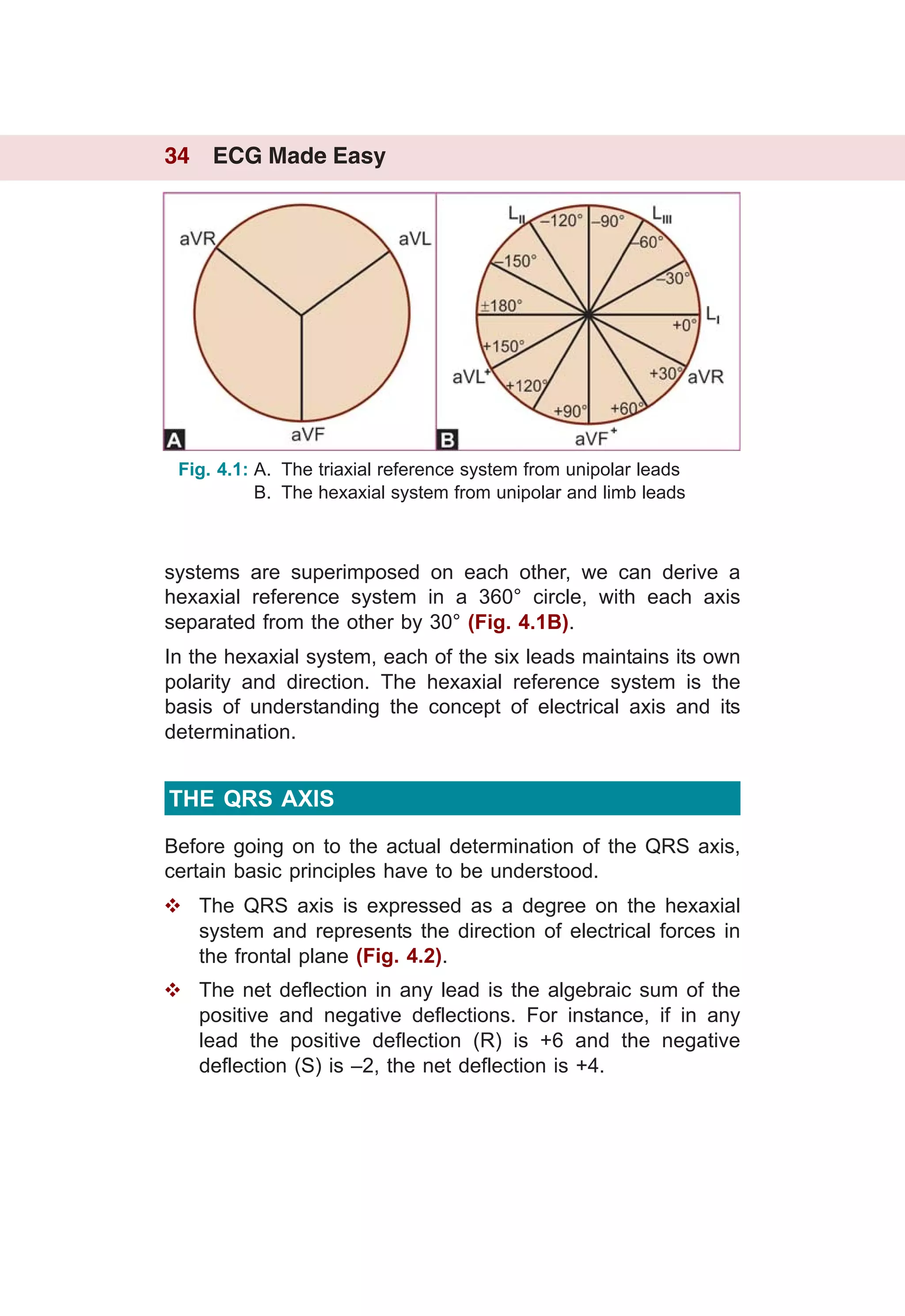 Ecg made easy | PDF