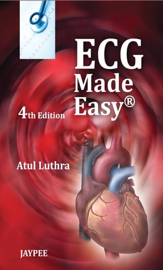 Ecg made easy | PDF