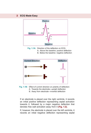 Ecg made easy | PDF