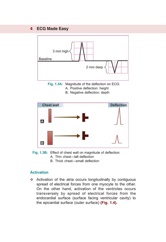 Ecg made easy | PDF