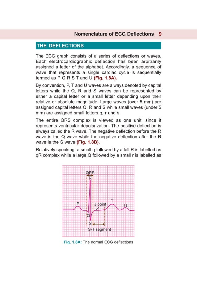 Ecg made easy | PDF