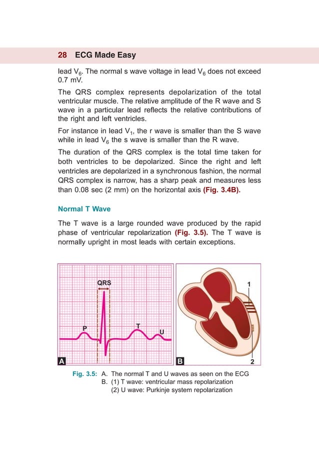 Ecg made easy | PDF